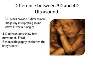 3D and 4D ultrasound in obstetrics | PPTX