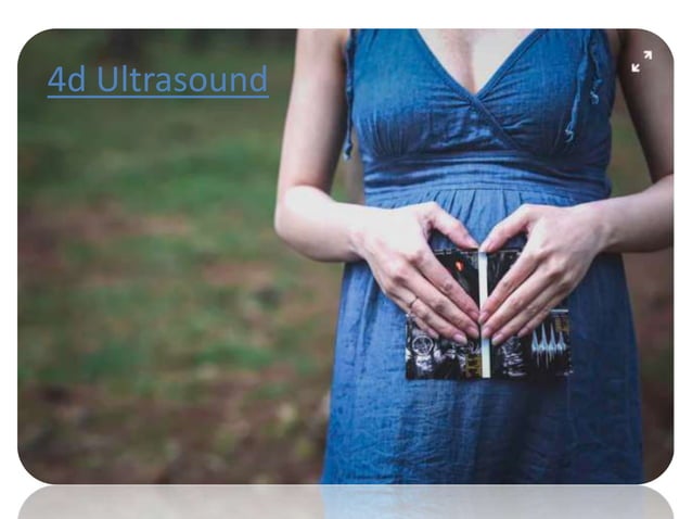 3 d and 4d ultrasound pictures | PPTX