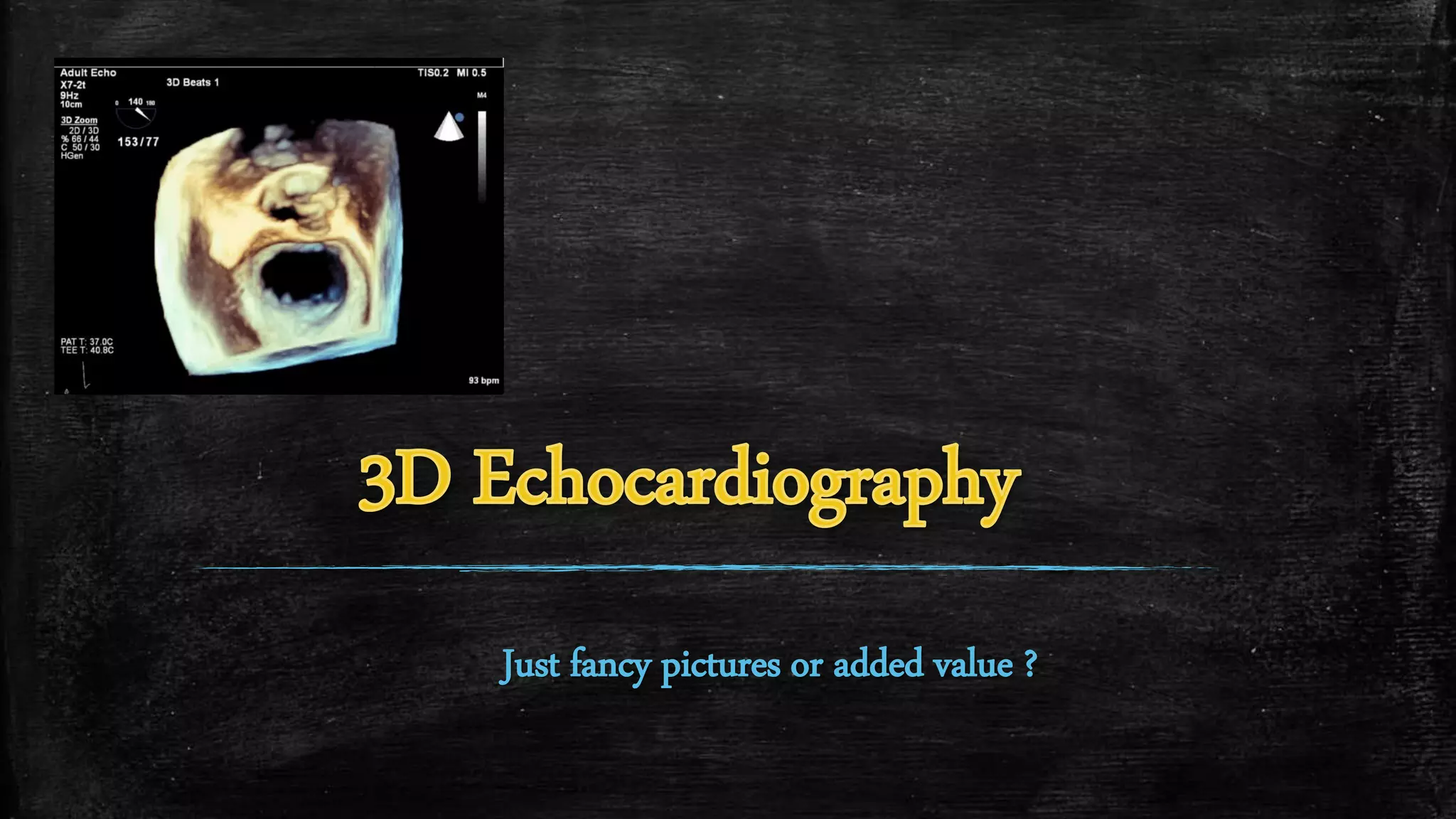 3D Echocardiography | PPTX