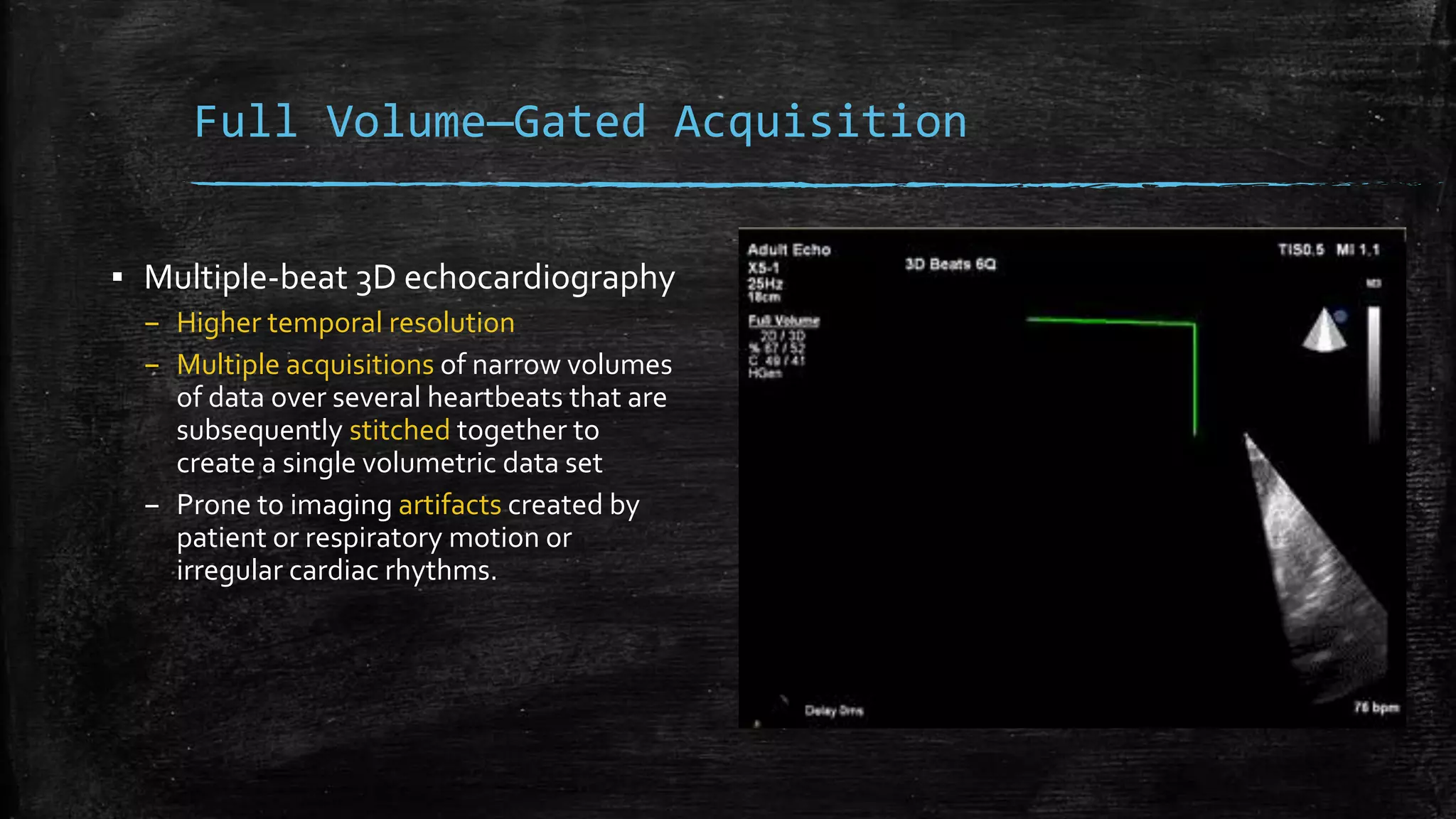 3D Echocardiography | PPTX