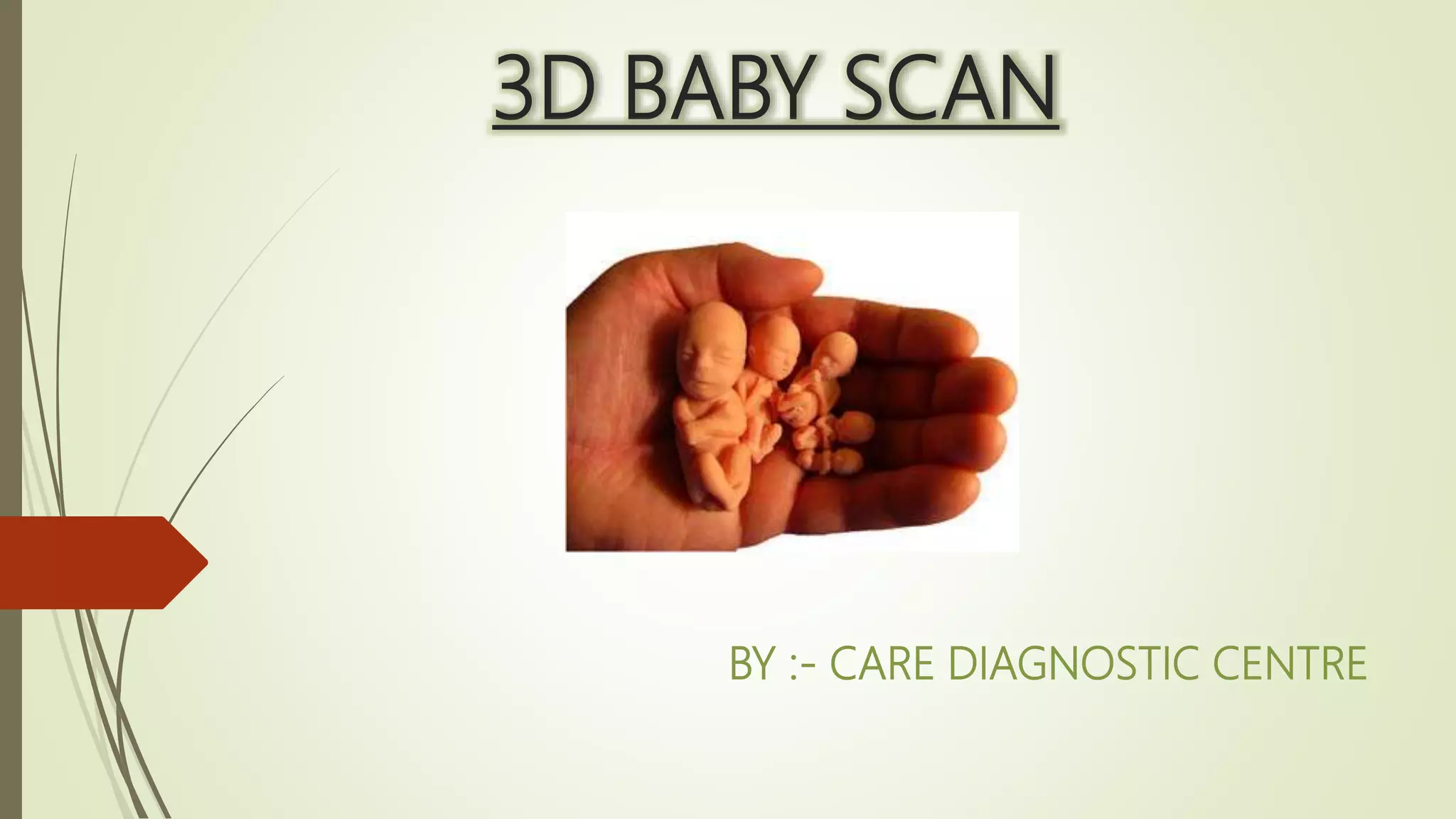 3D Baby Scan | PPT