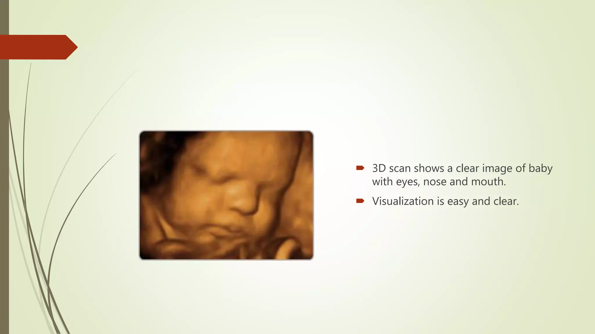 3D Baby Scan | PPT