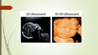 3D Baby Scan | PPTX