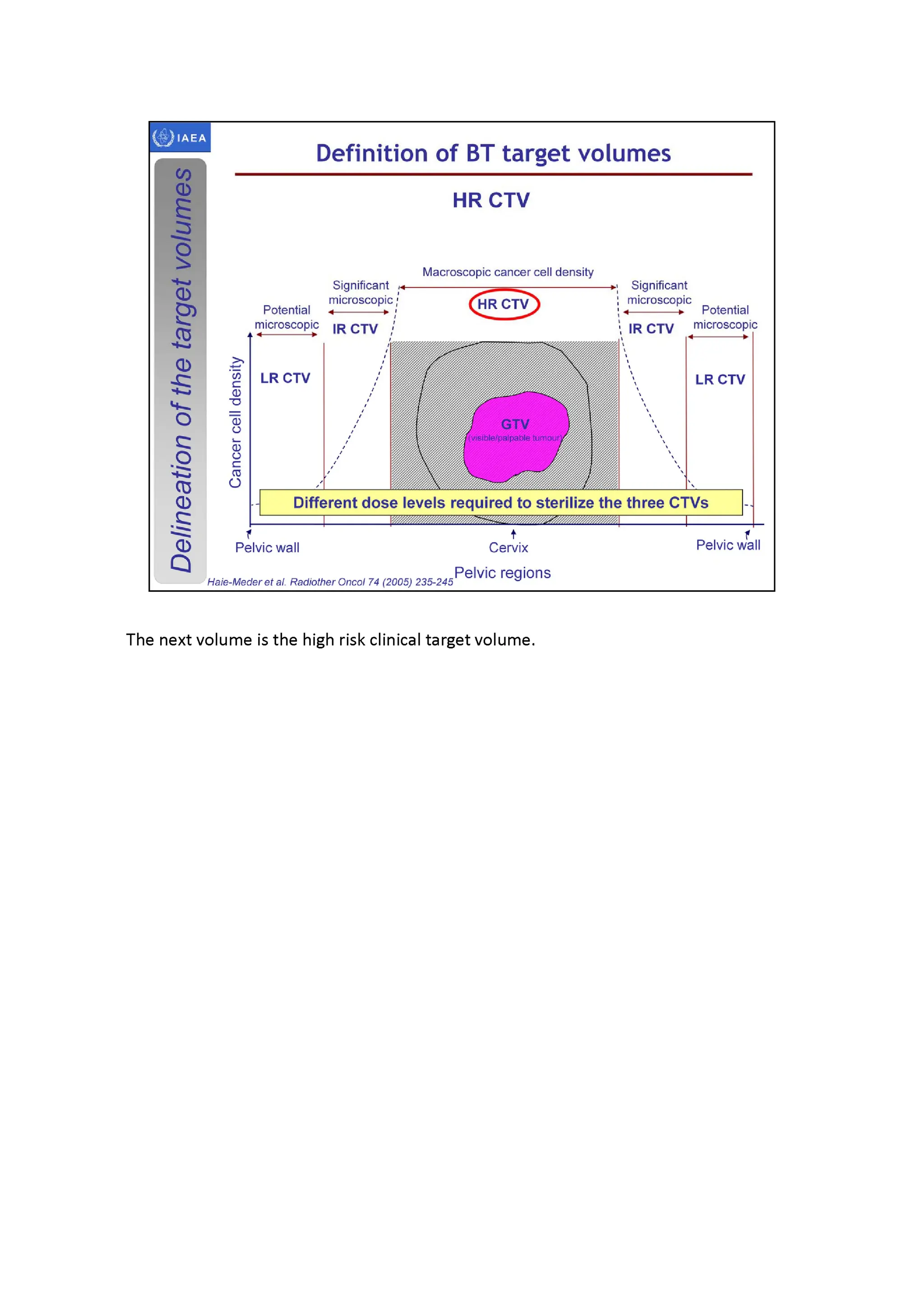 3D brachytherapy - definition and delineation of the target volumes ...