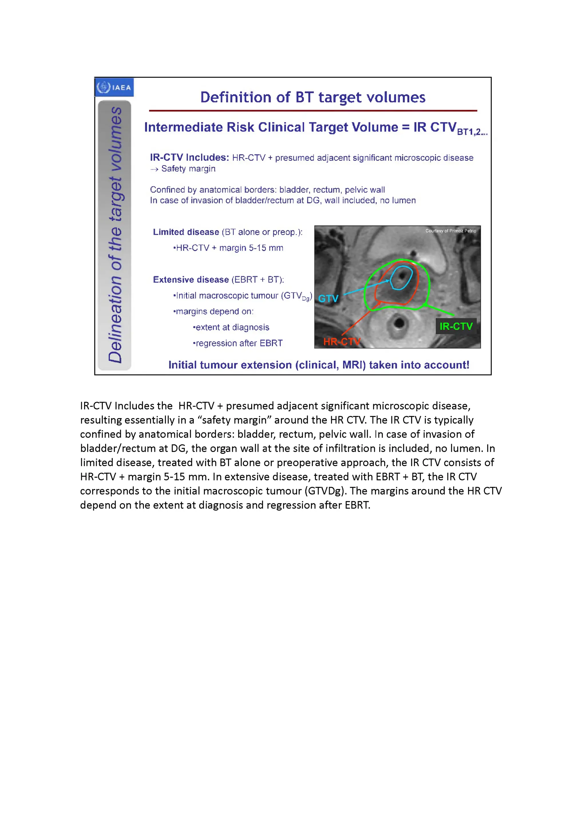 3D brachytherapy - definition and delineation of the target volumes ...