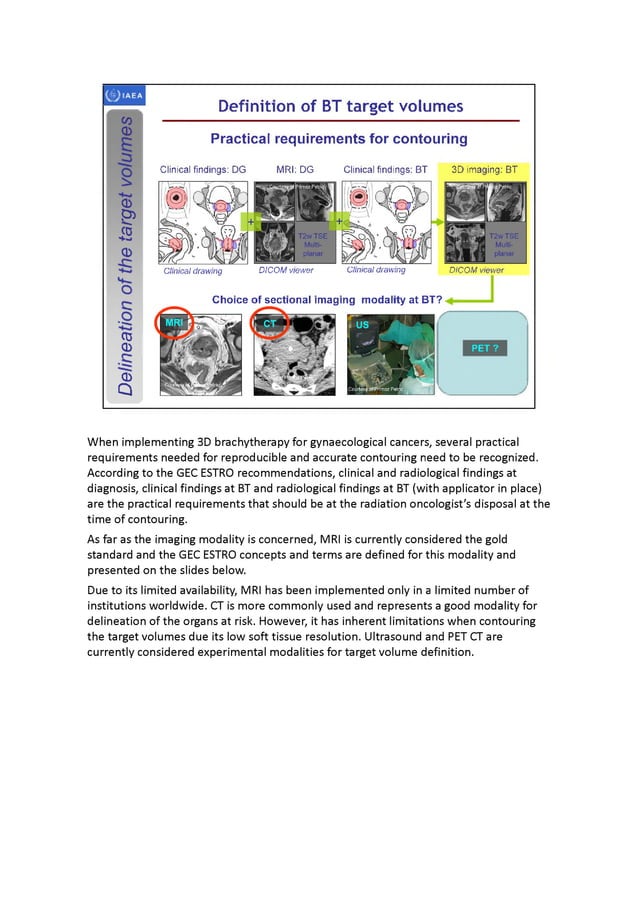 3D brachytherapy - definition and delineation of the target volumes ...