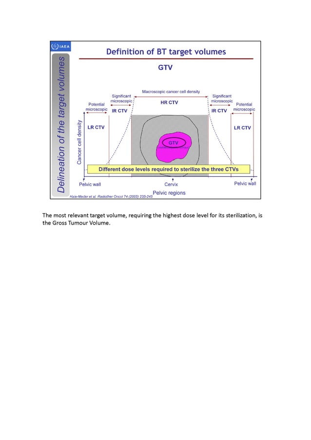 3D brachytherapy - definition and delineation of the target volumes ...