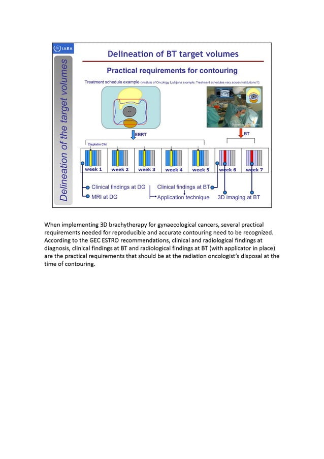 3D brachytherapy - definition and delineation of the target volumes ...