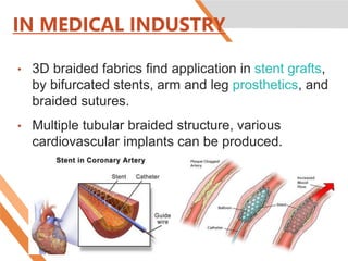 3D Braiding Technology & Application | PPTX
