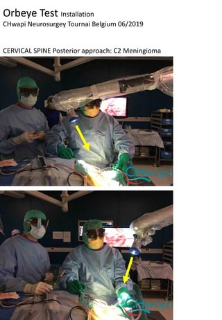 Microsurgery without eyepieces 3D screen heads-up position | PDF