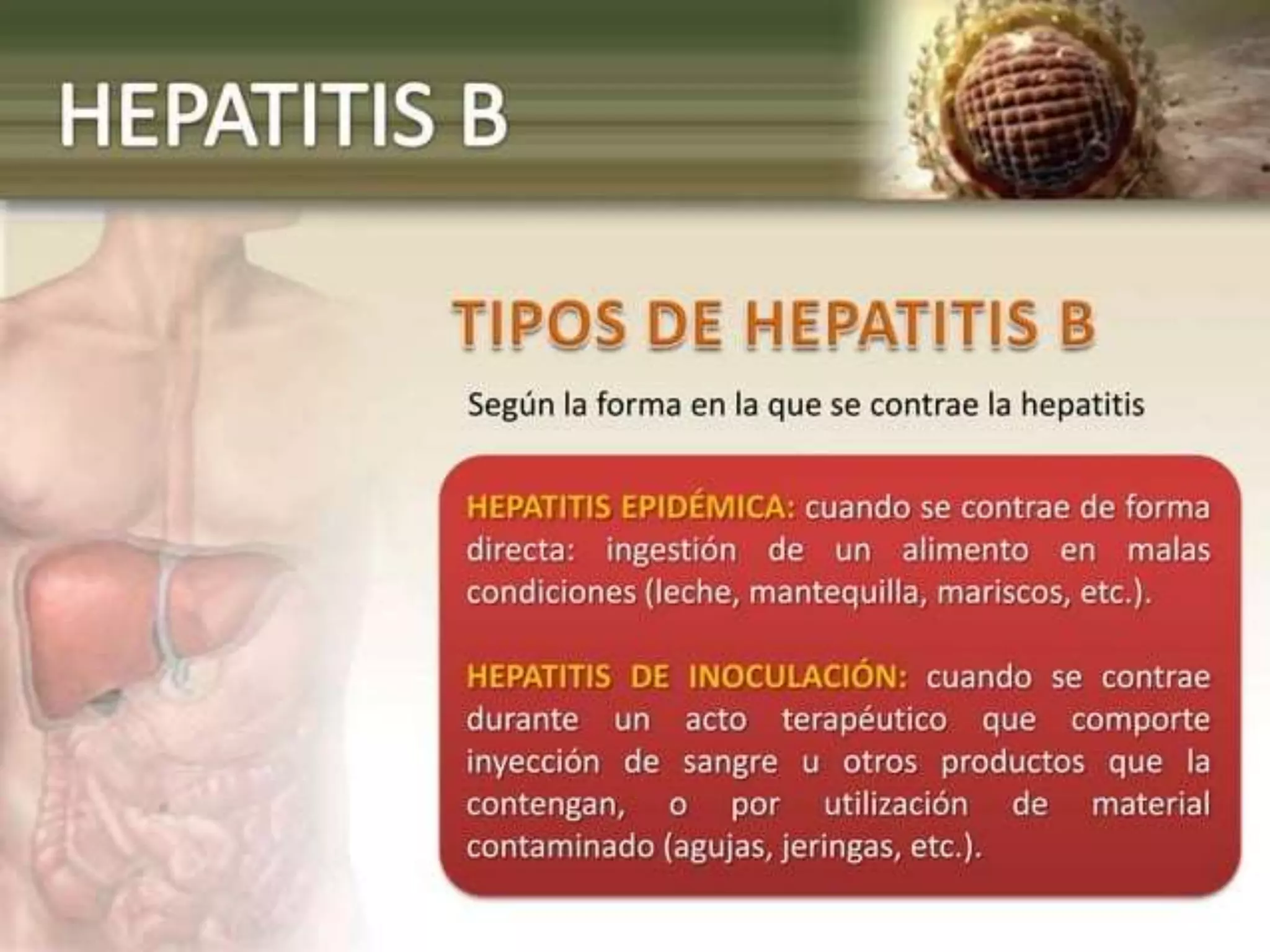 hepatitis b | PPT