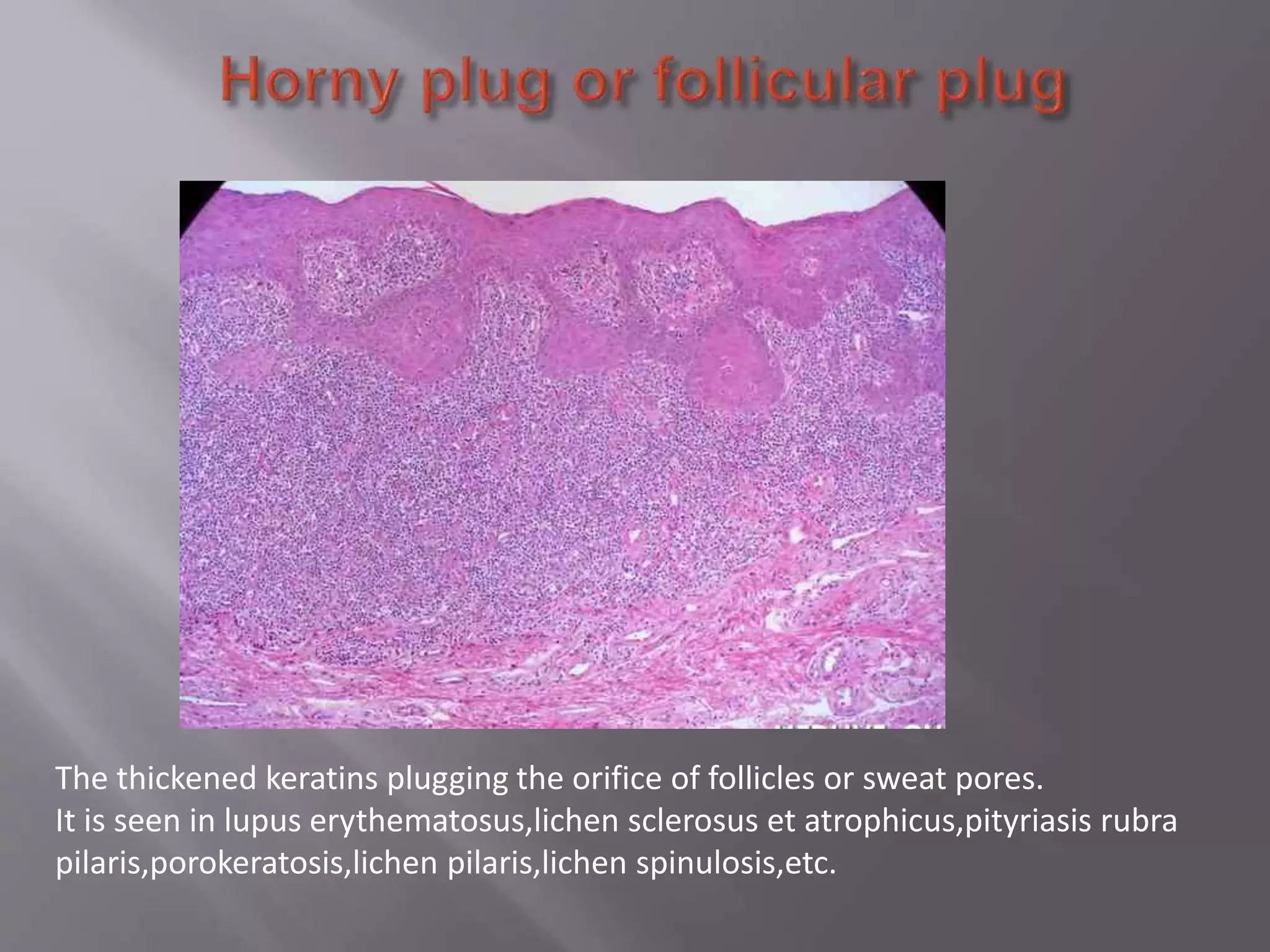 3 Dermatopathology.pptx