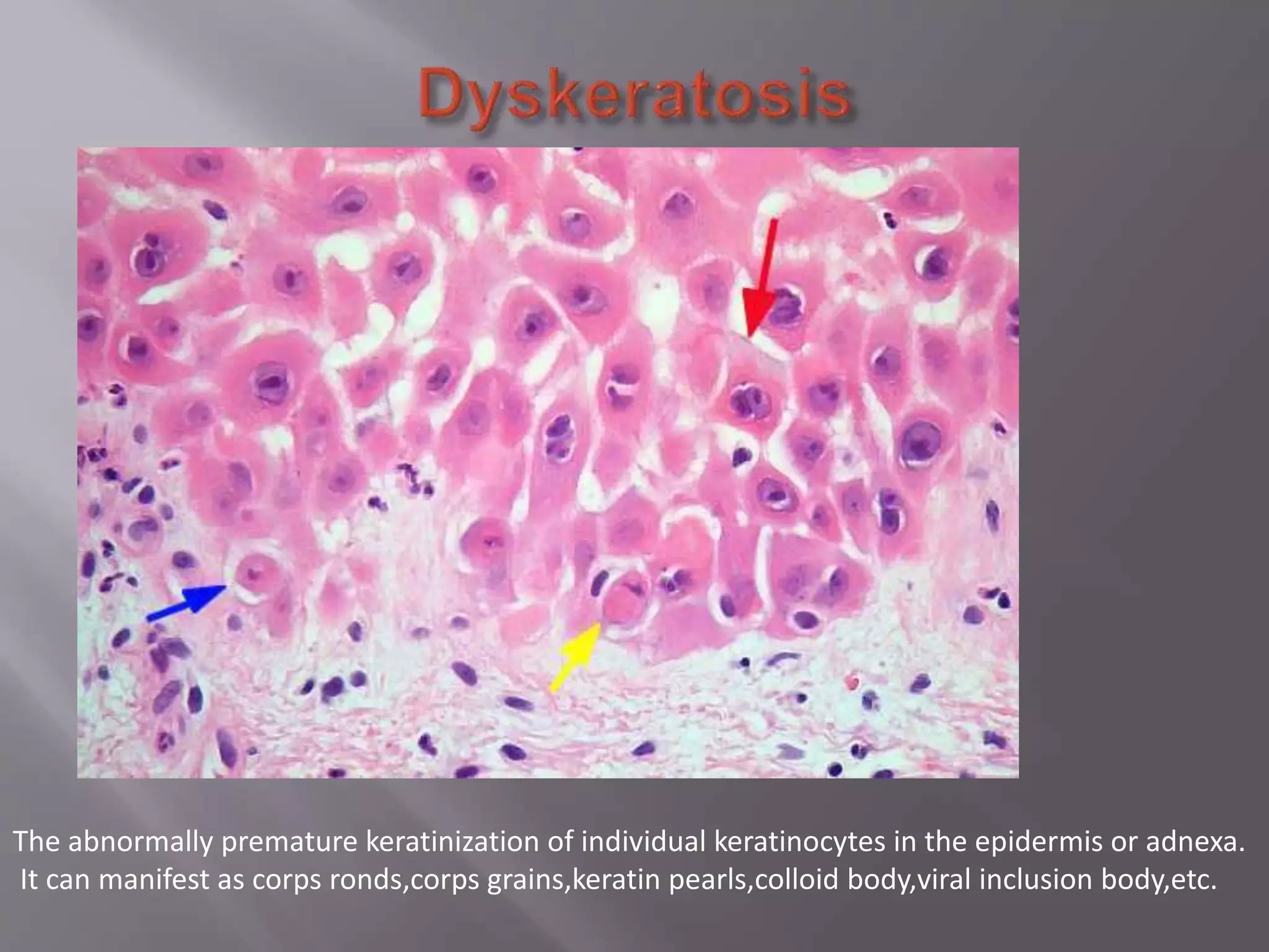 3 Dermatopathology.pptx