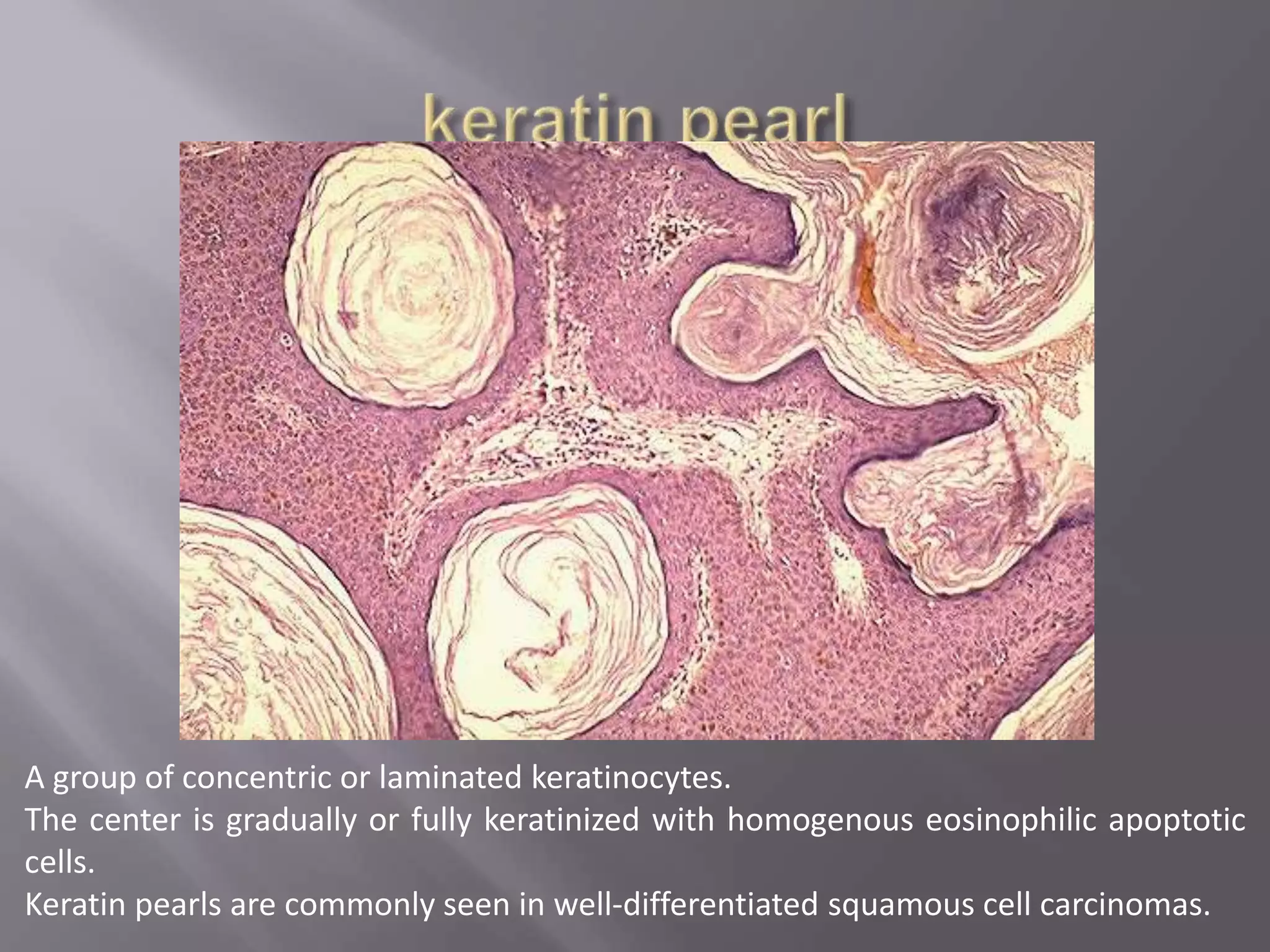 3 Dermatopathology.pptx