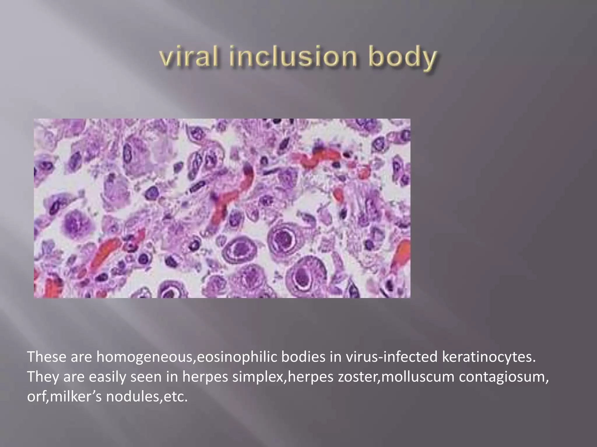 3 Dermatopathology.pptx