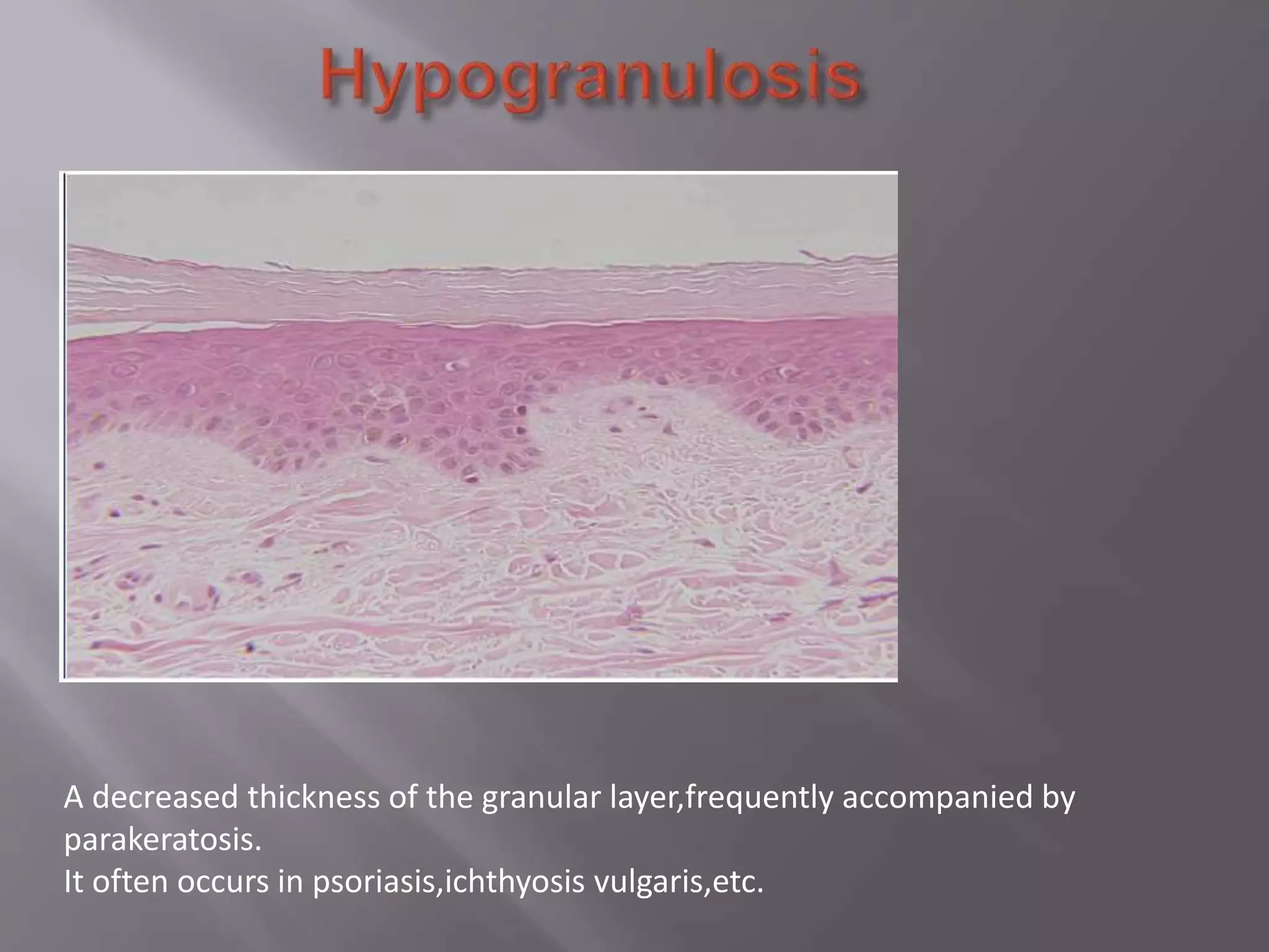 3 Dermatopathology.pptx