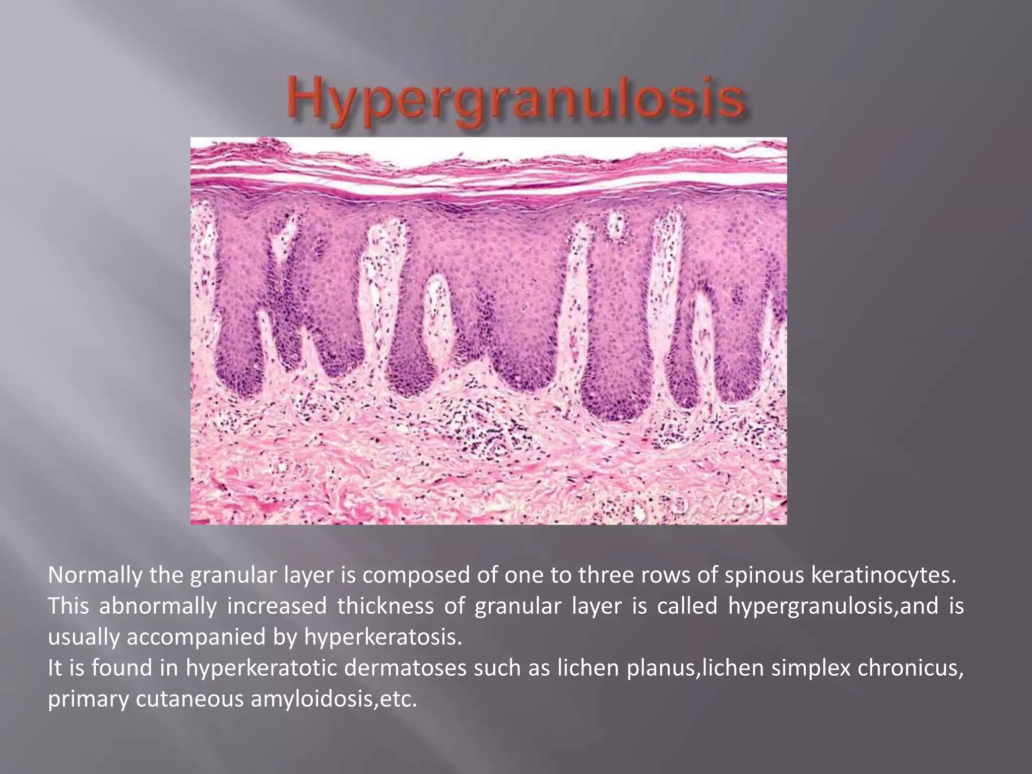 3 Dermatopathology.pptx