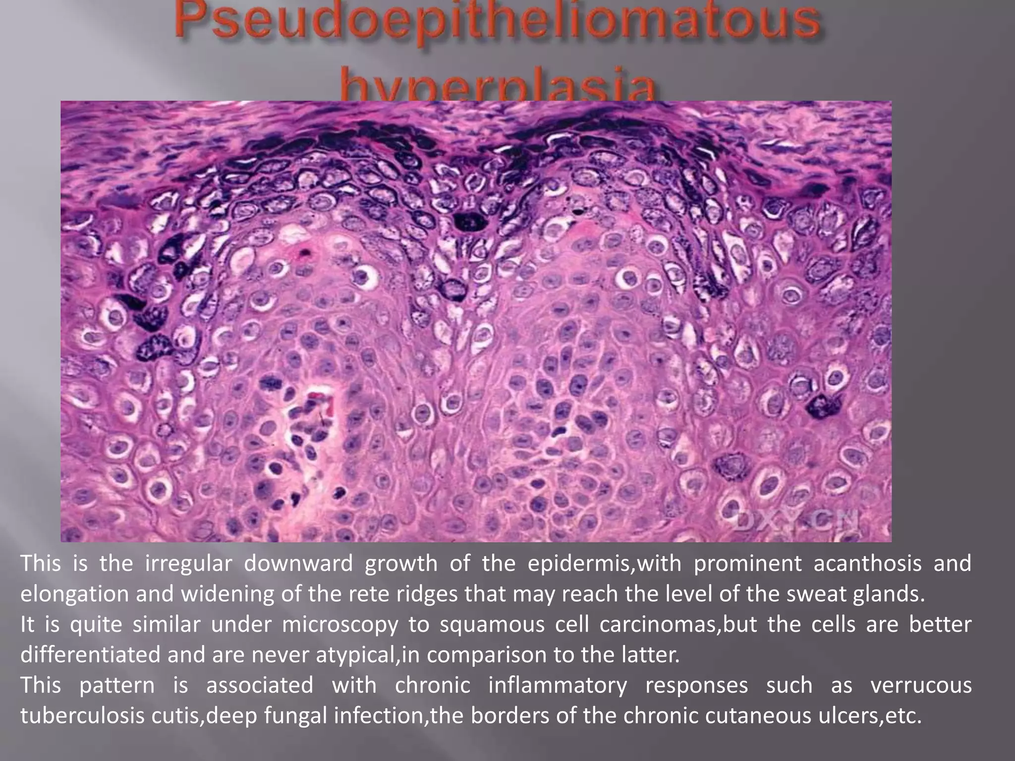 3 Dermatopathology.pptx