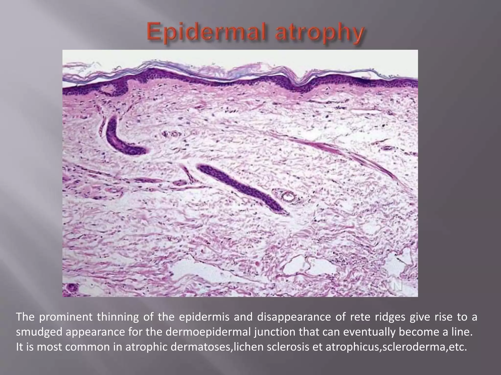 3 Dermatopathology.pptx