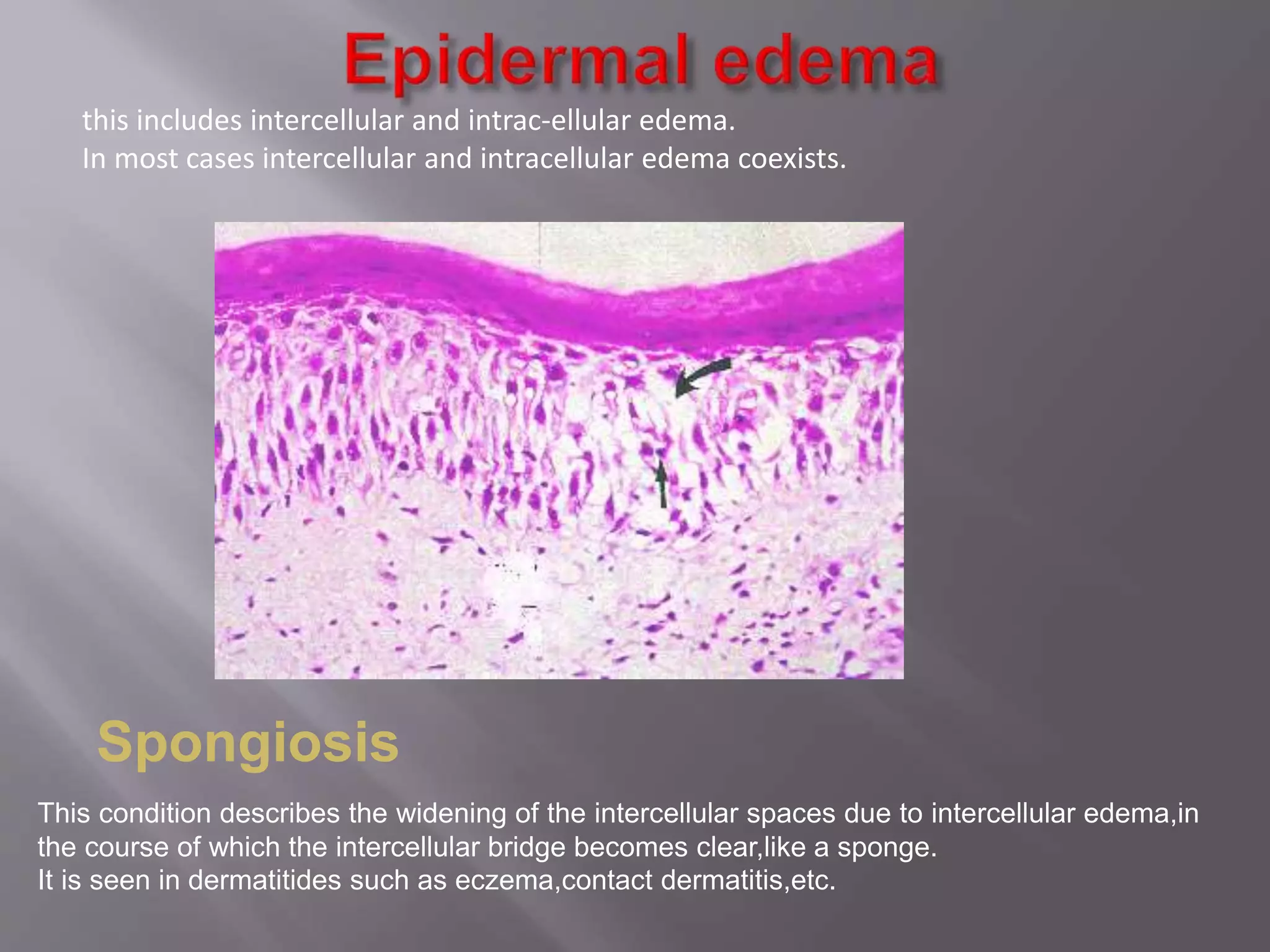 3 Dermatopathology.pptx