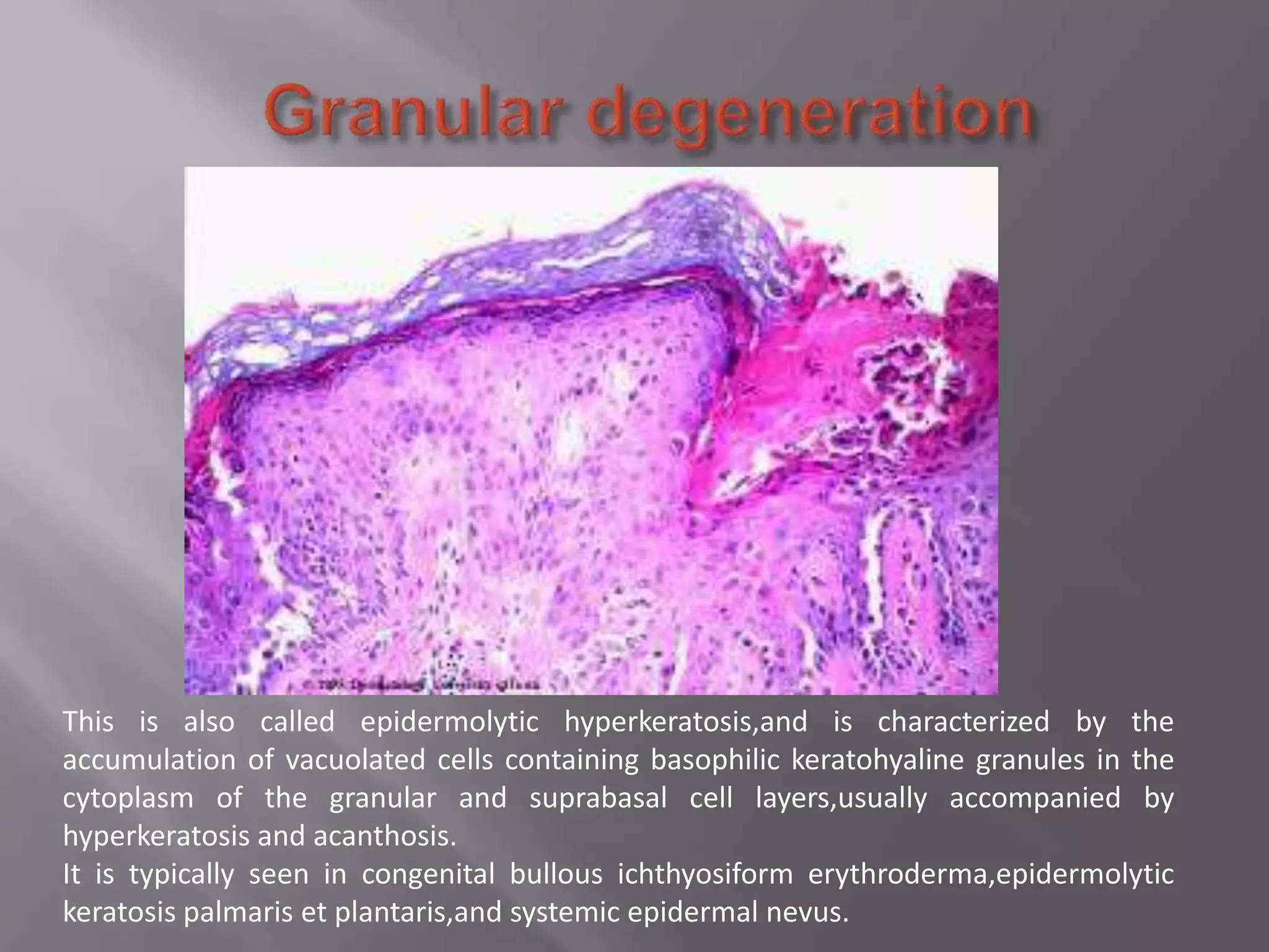 3 Dermatopathology.pptx
