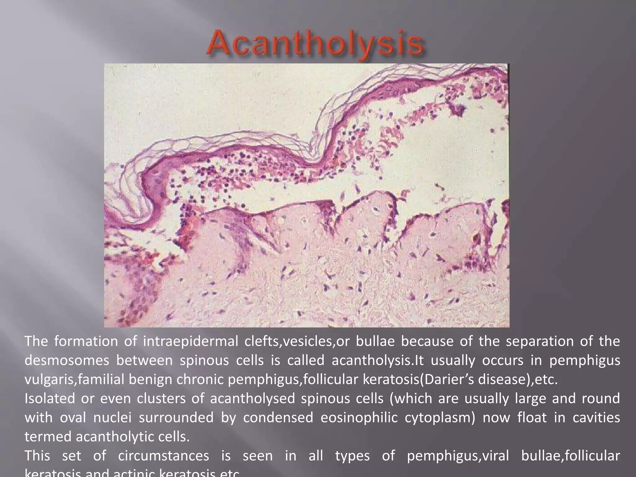 3 Dermatopathology.pptx