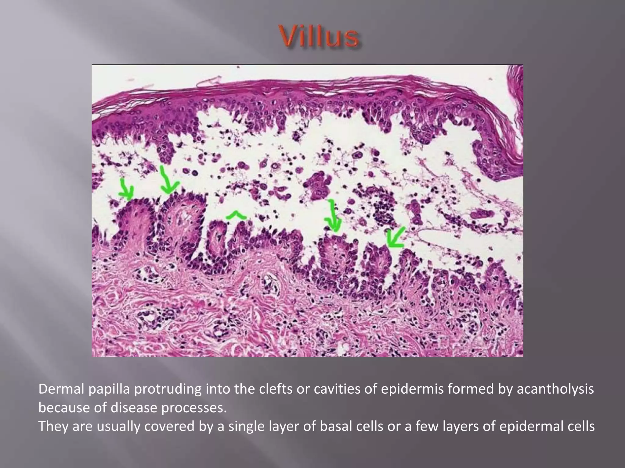 3 Dermatopathology.pptx