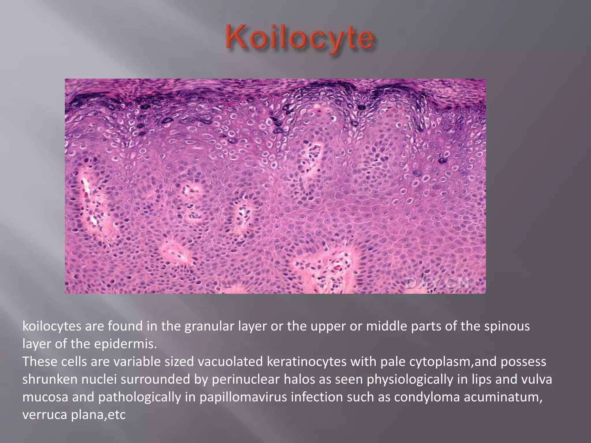 3 Dermatopathology.pptx