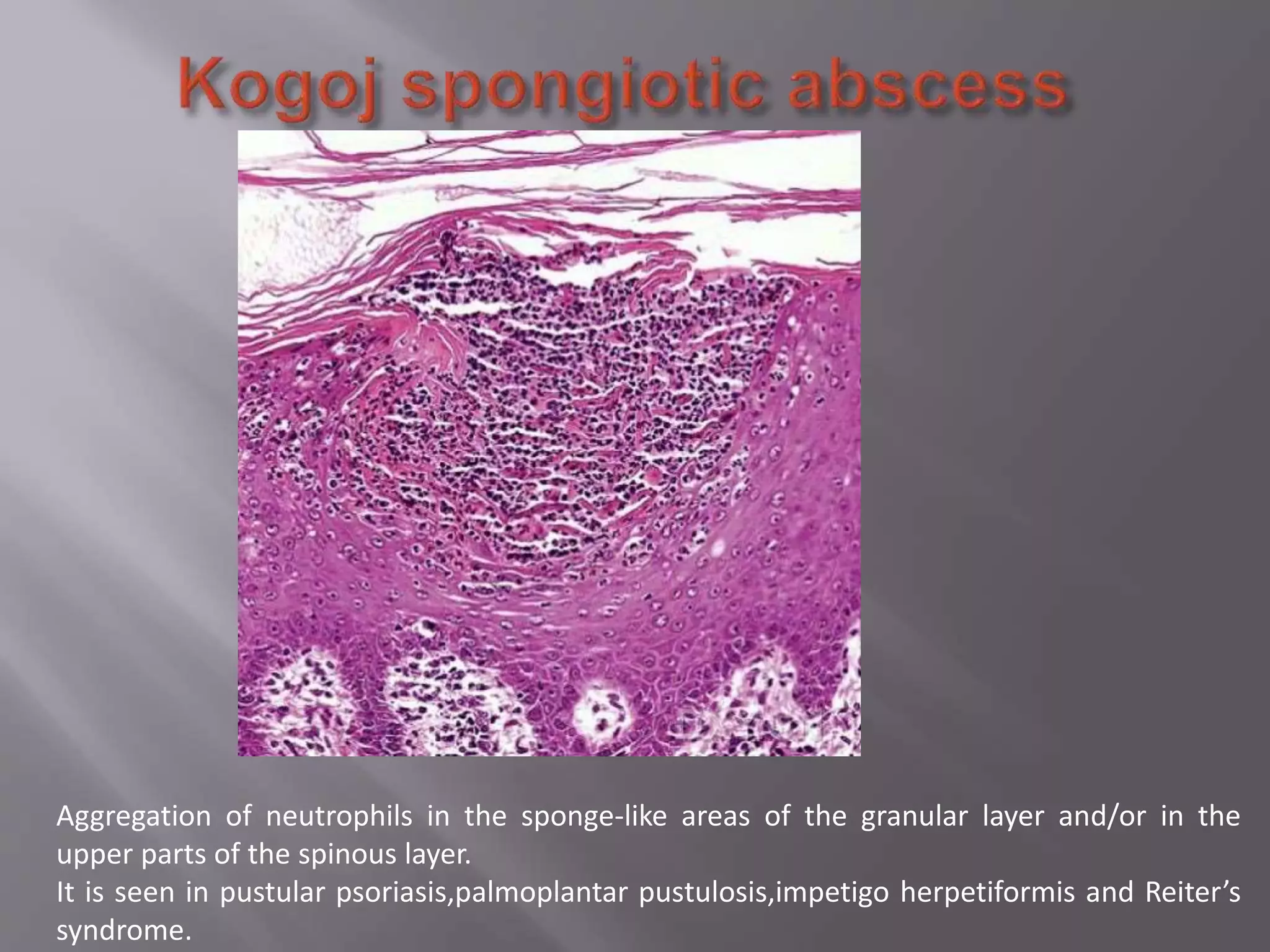 3 Dermatopathology.pptx