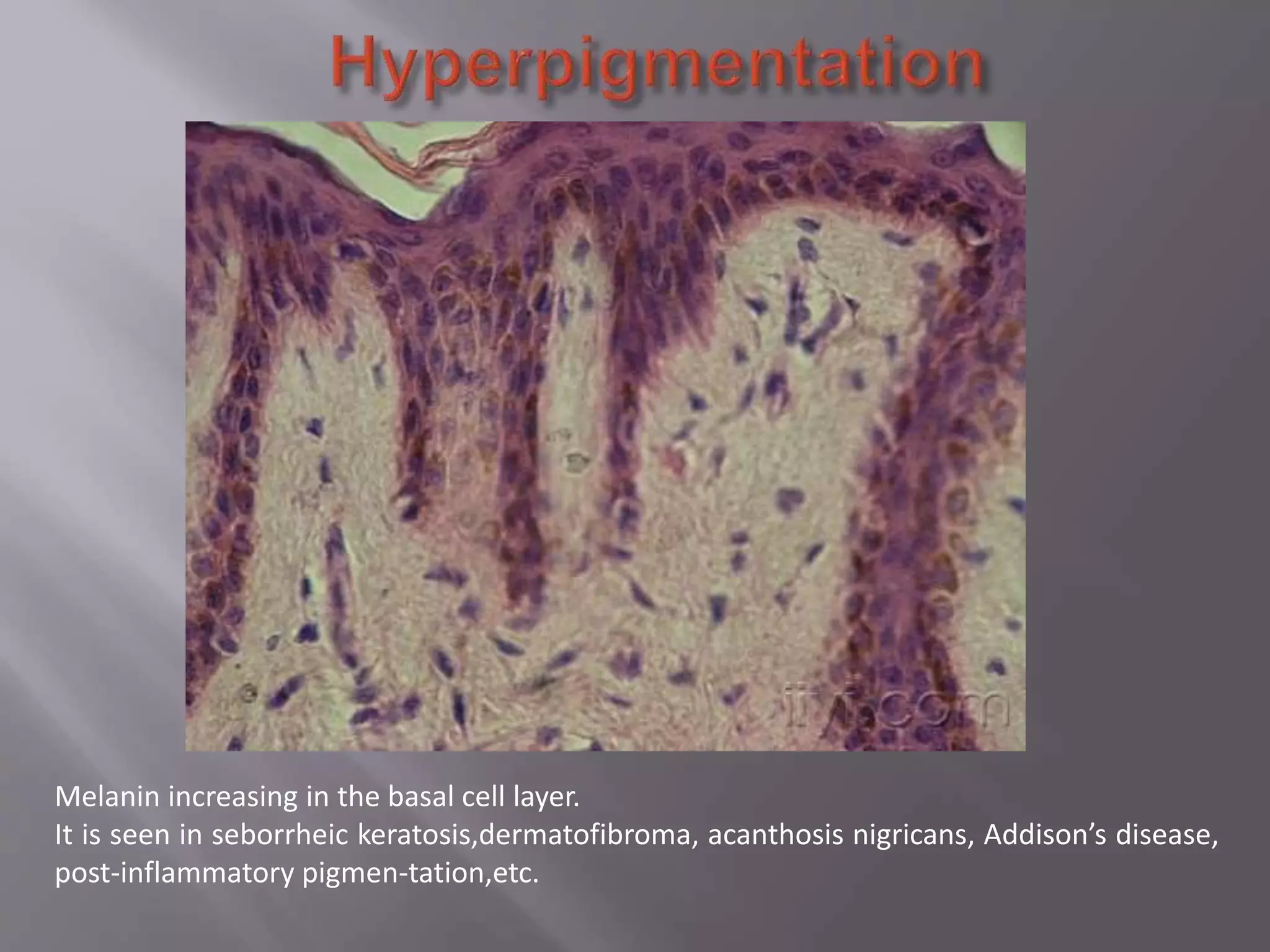 3 Dermatopathology.pptx