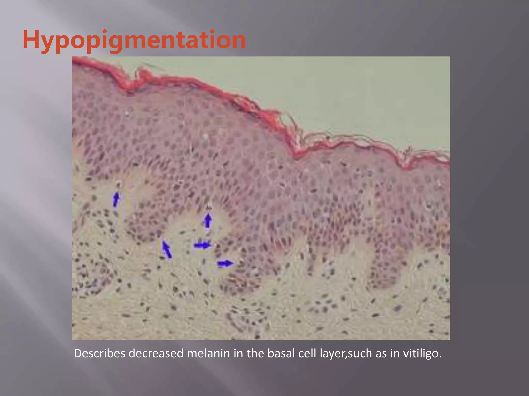 3 Dermatopathology.pptx