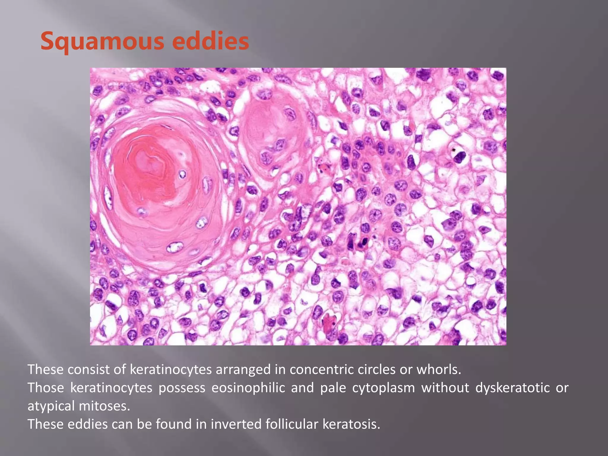 3 Dermatopathology.pptx