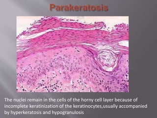 3 Dermatopathology.pptx