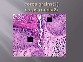 3 Dermatopathology.pptx