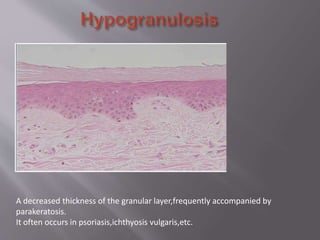3 Dermatopathology.pptx