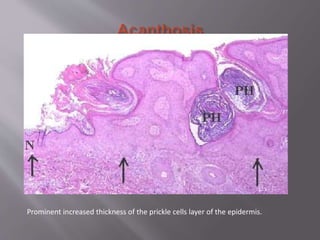 3 Dermatopathology.pptx