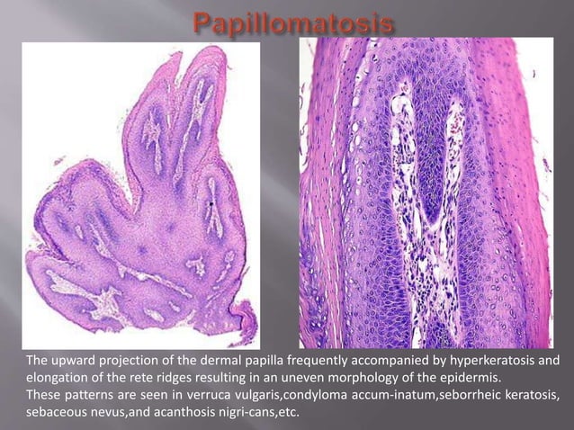 3 Dermatopathology.pptx | Skin and Dermatology | Diseases and Conditions