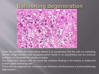 3 Dermatopathology.pptx