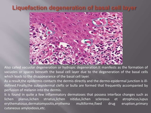 3 Dermatopathology.pptx | Skin and Dermatology | Diseases and Conditions