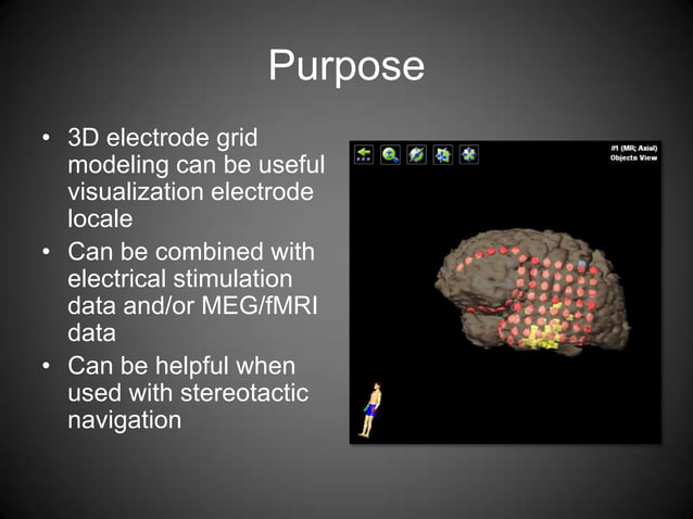 3 D Grid Modeling With Brain Lab | PPTX