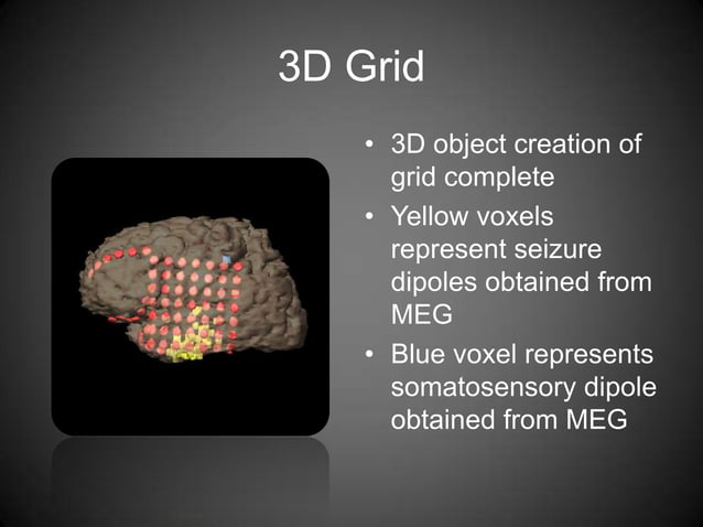 3 D Grid Modeling With Brain Lab | PPTX