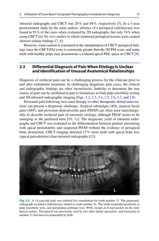 3 d imaging in endodontics a new era in diagnosis and treatment | PDF