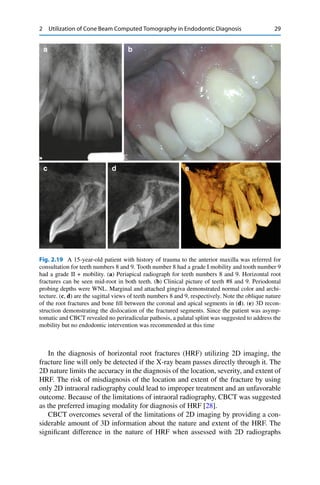 3 d imaging in endodontics a new era in diagnosis and treatment | PDF