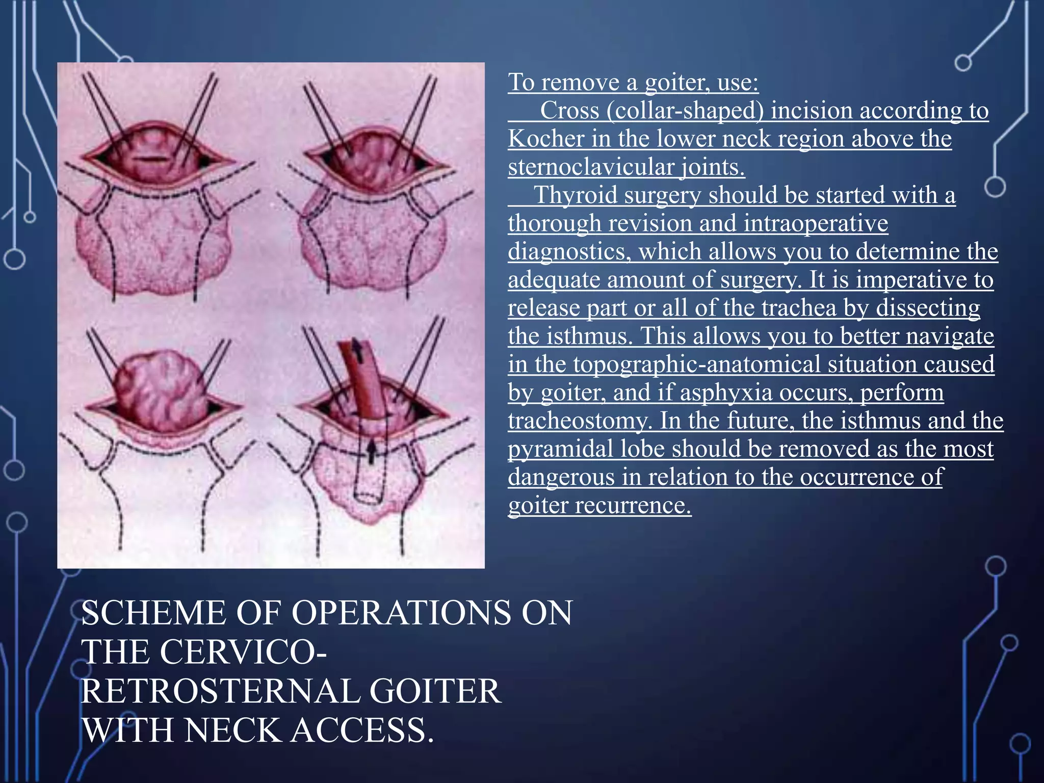 3 Diseases of the thyroid gland (2).ppt