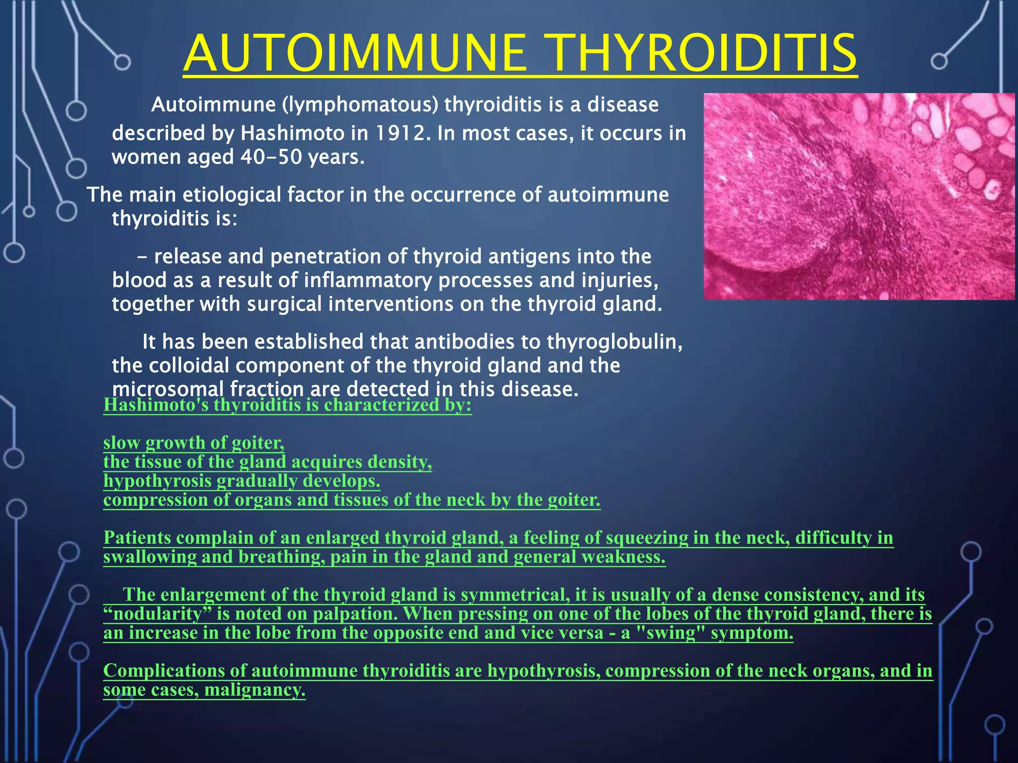 3 Diseases of the thyroid gland (2).ppt
