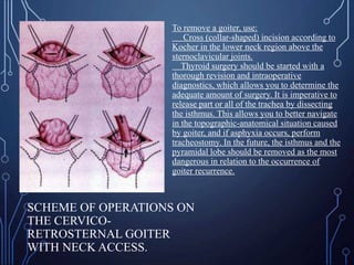 3 Diseases of the thyroid gland (2).ppt