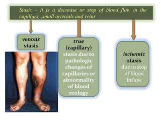 3 Disturbabce of blood circulation 2021.pdf