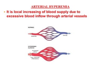 3 Disturbabce of blood circulation 2021.pdf