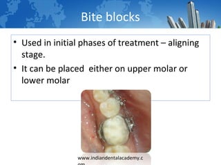 3d maxillary 1st molar positional considerations | PPT