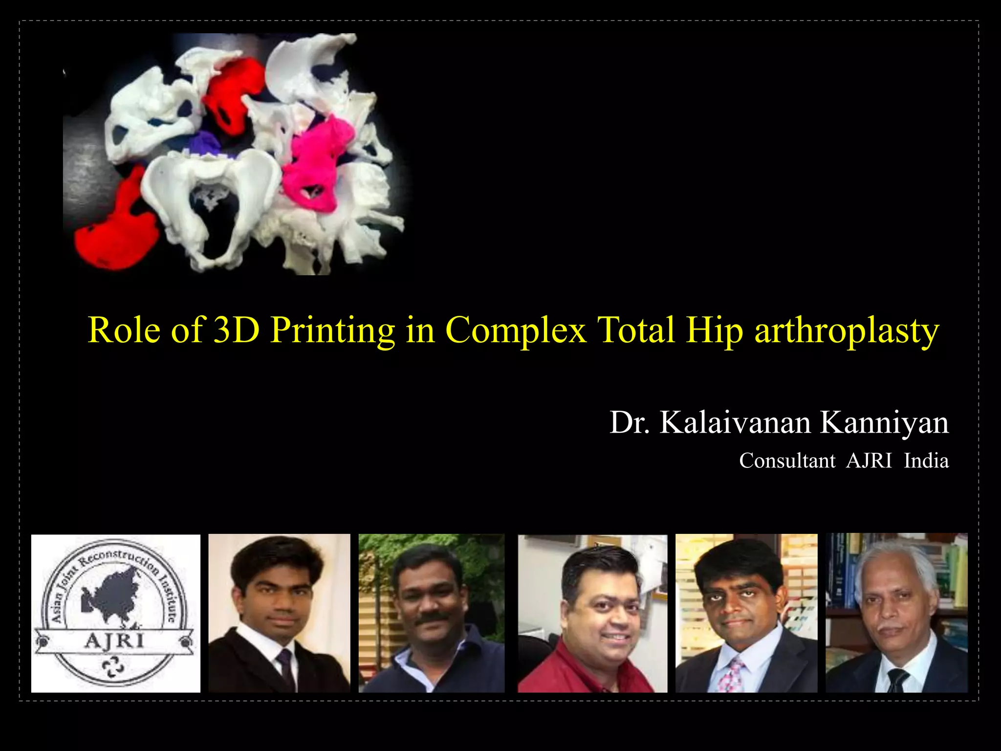 Role of 3D printing & 3D model in Complex Total Hip Replacement | PPT